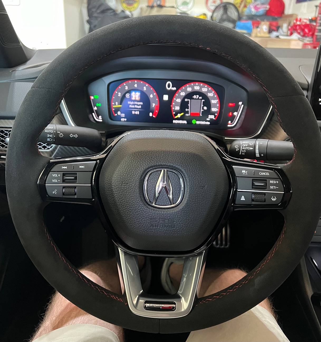 24 Liquid Carbon Type-S Intro & Build | Page 2 | IntegraForums - 2023 ...